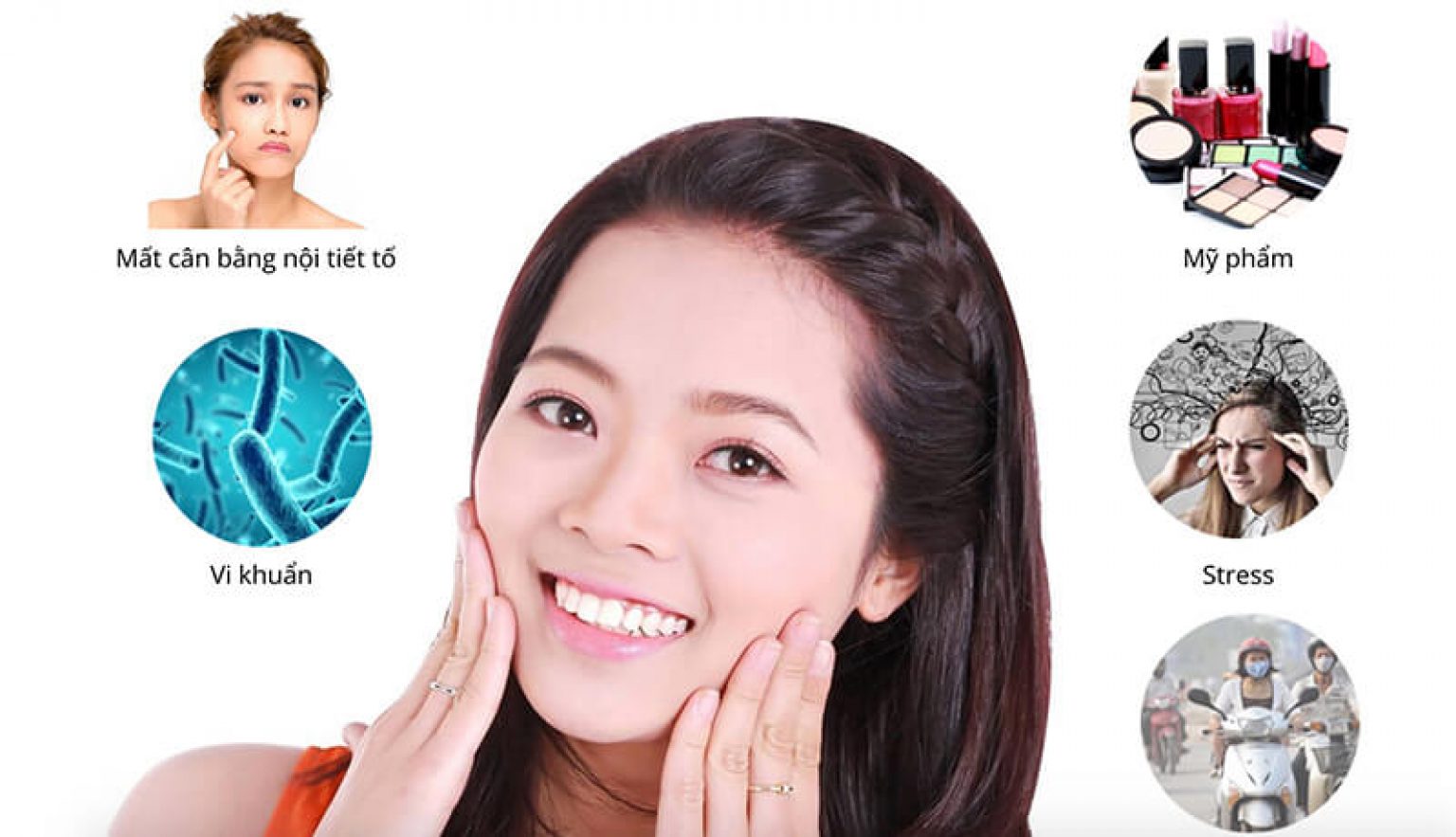 Gel trị mụn Decumar: Công dụng tuyệt vời giúp đánh bay mụn hiệu quả